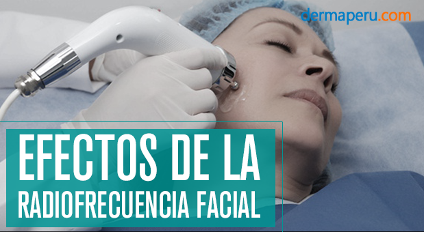 Radiofrecuencia en el Rostro: ¿Cuáles son los efectos de la ...